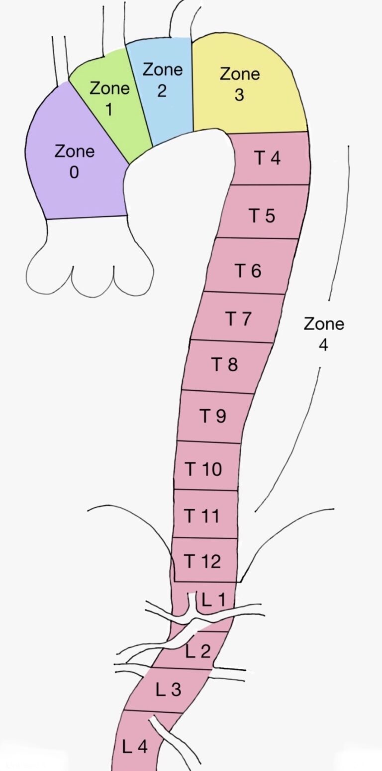 いまさら聞きにくいTEVARのゾーン（zone）について