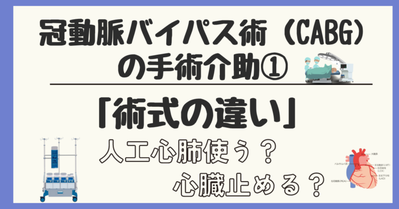 【術式の違い】冠動脈バイパス術（CABG）の手術介助①