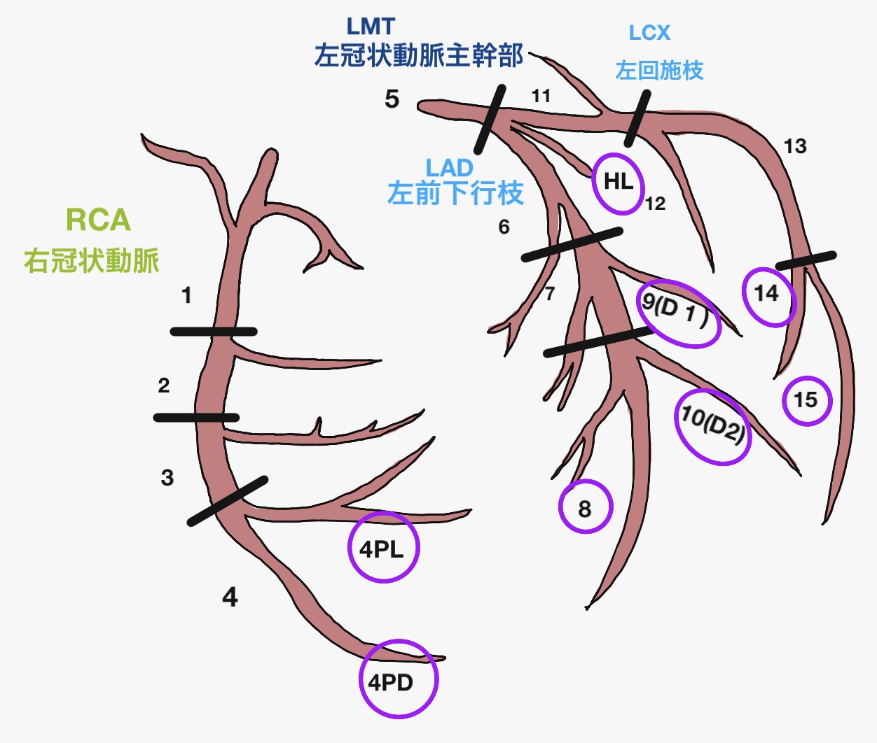 【解剖・グラフトの理解】冠動脈バイパス術（CABG）の手術介助②