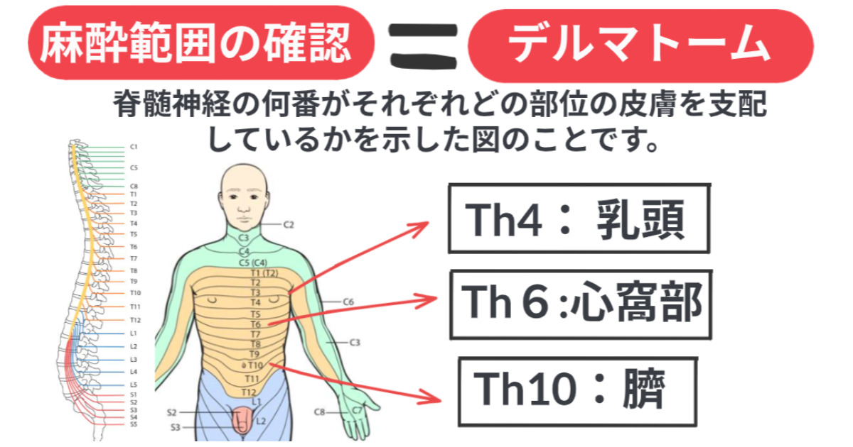 脊椎くも膜下麻酔 基本知識